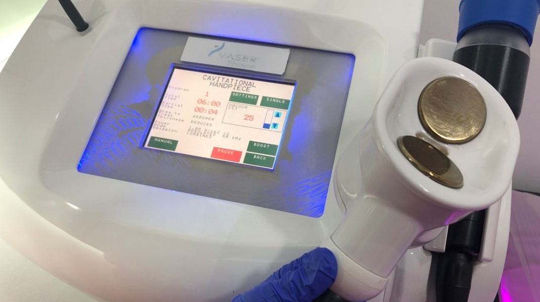 Έκανα vaser shape και μέσα σε μισή ώρα έχασα πόντους από την κοιλιά και ...