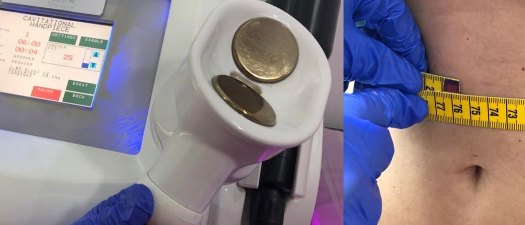 Vaser Shape | BOVARY