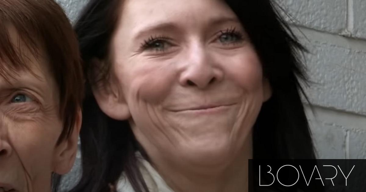 Η 25χρονη που μοιάζει 40 χρόνια μεγαλύτερη λόγω σπάνιας πάθησης | BOVARY