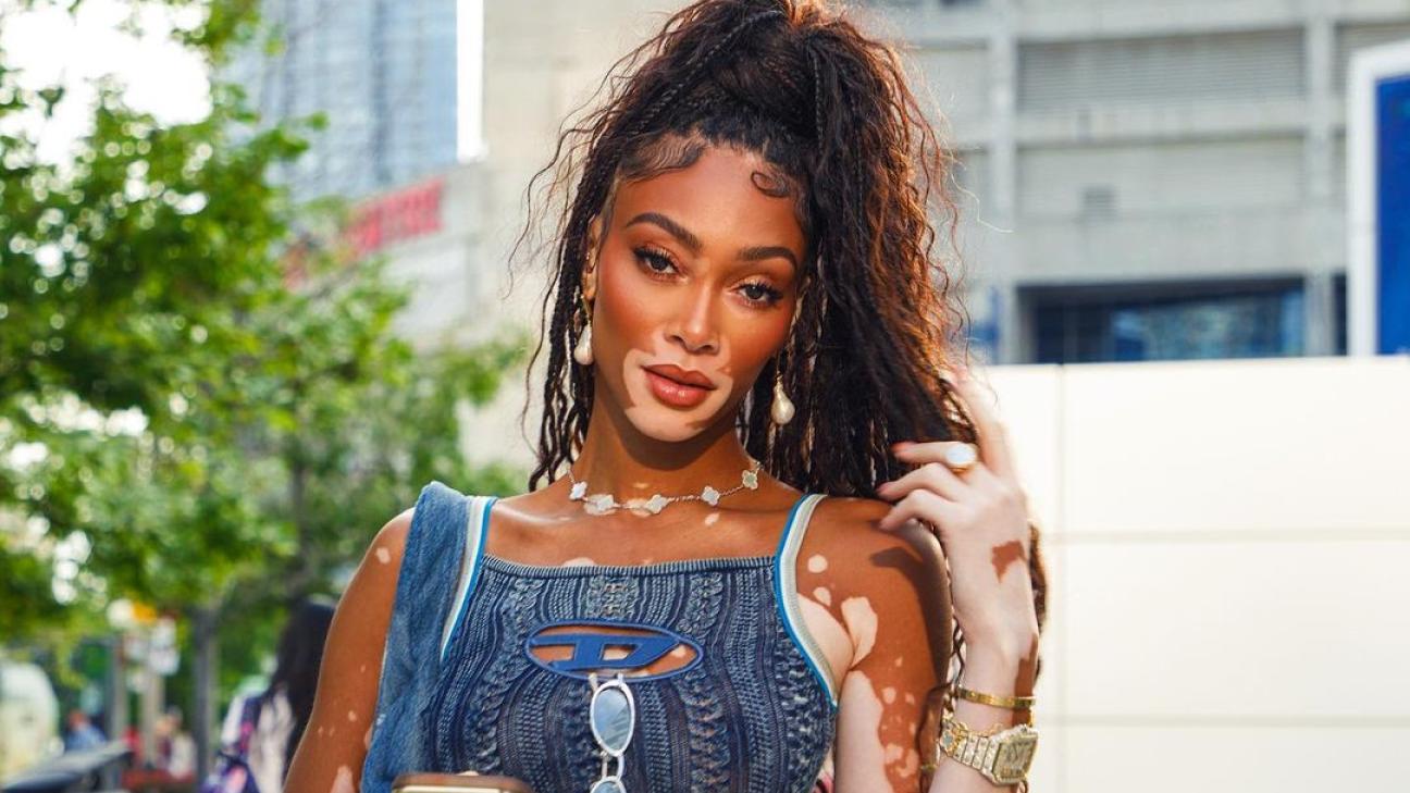 H Winnie Harlow αποχωρίστηκε τα μακριά της μαλλιά -Eκανε ένα pixie cut ...